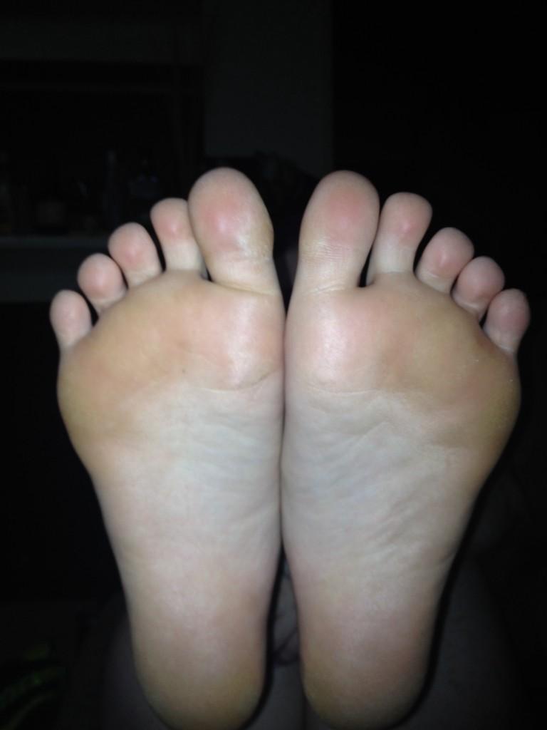 Allison Wyte's feet