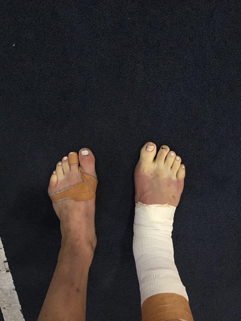 Brittany Rogers's feet