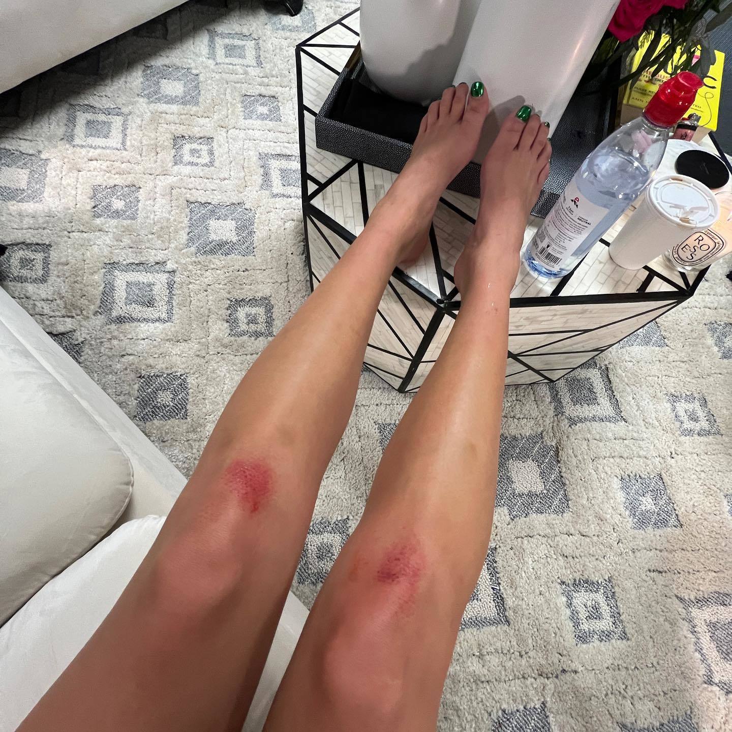Dua Lipas Feet
