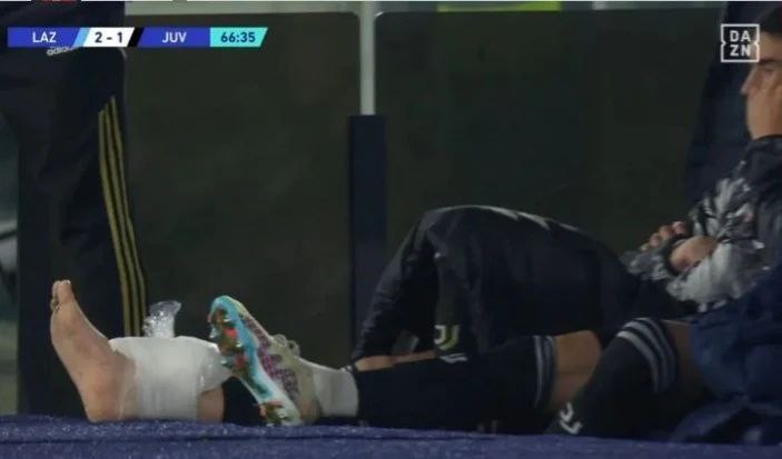 Dusan Vlahovic's feet