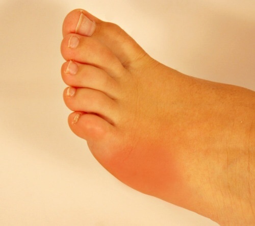 Emilie Voe Nerengs Feet