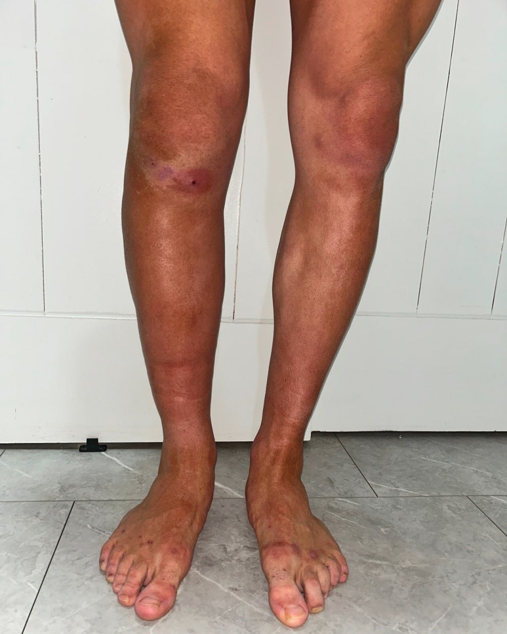 Jacob Kasper's feet