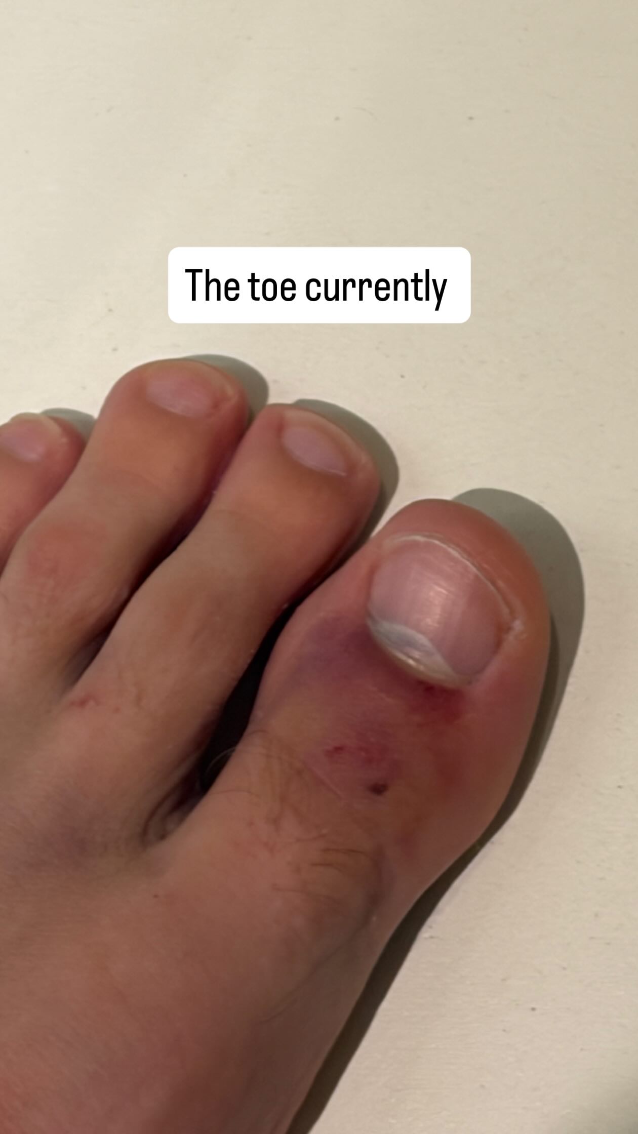Matt Rife's feet