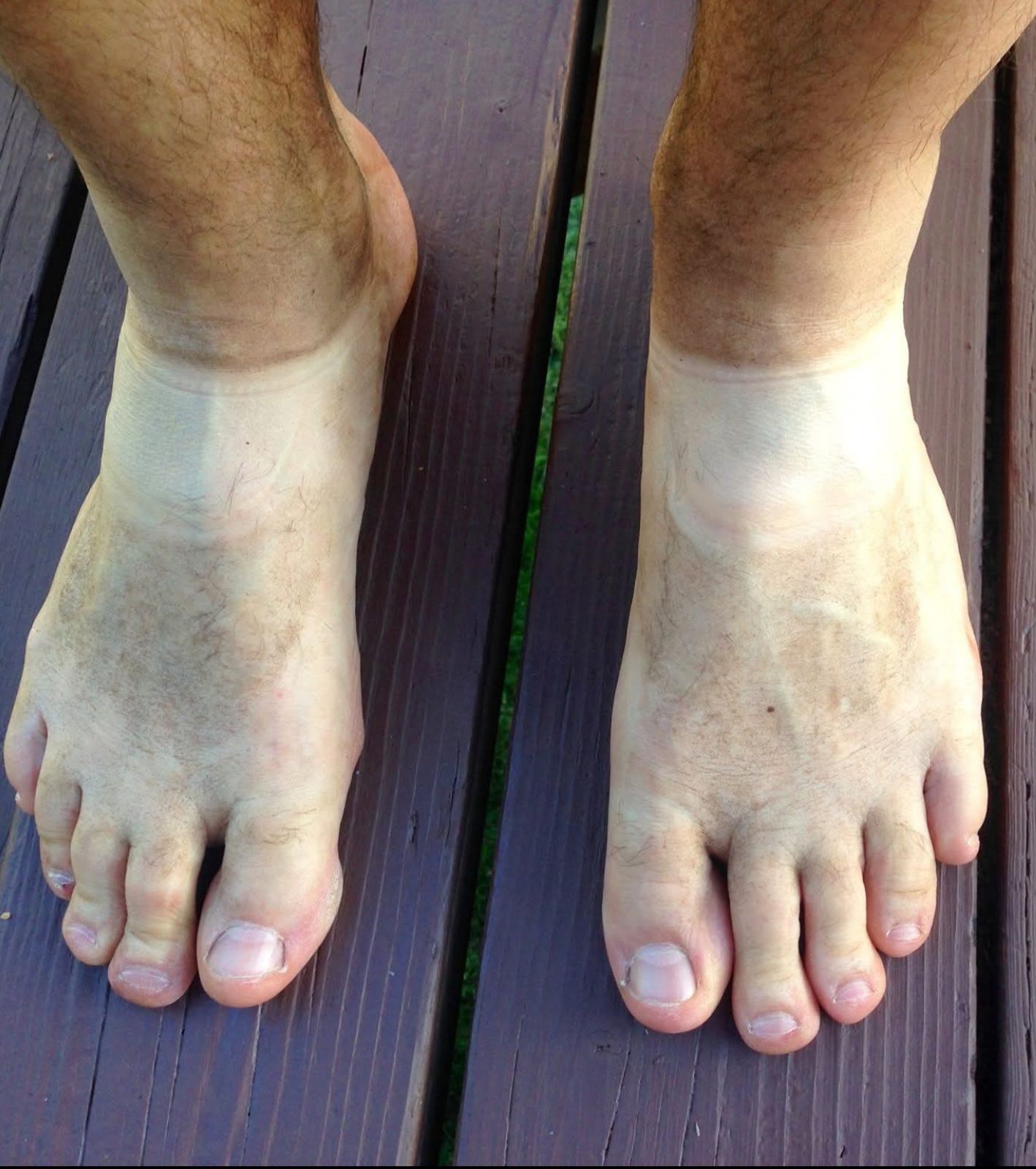 Matt Schultz's feet