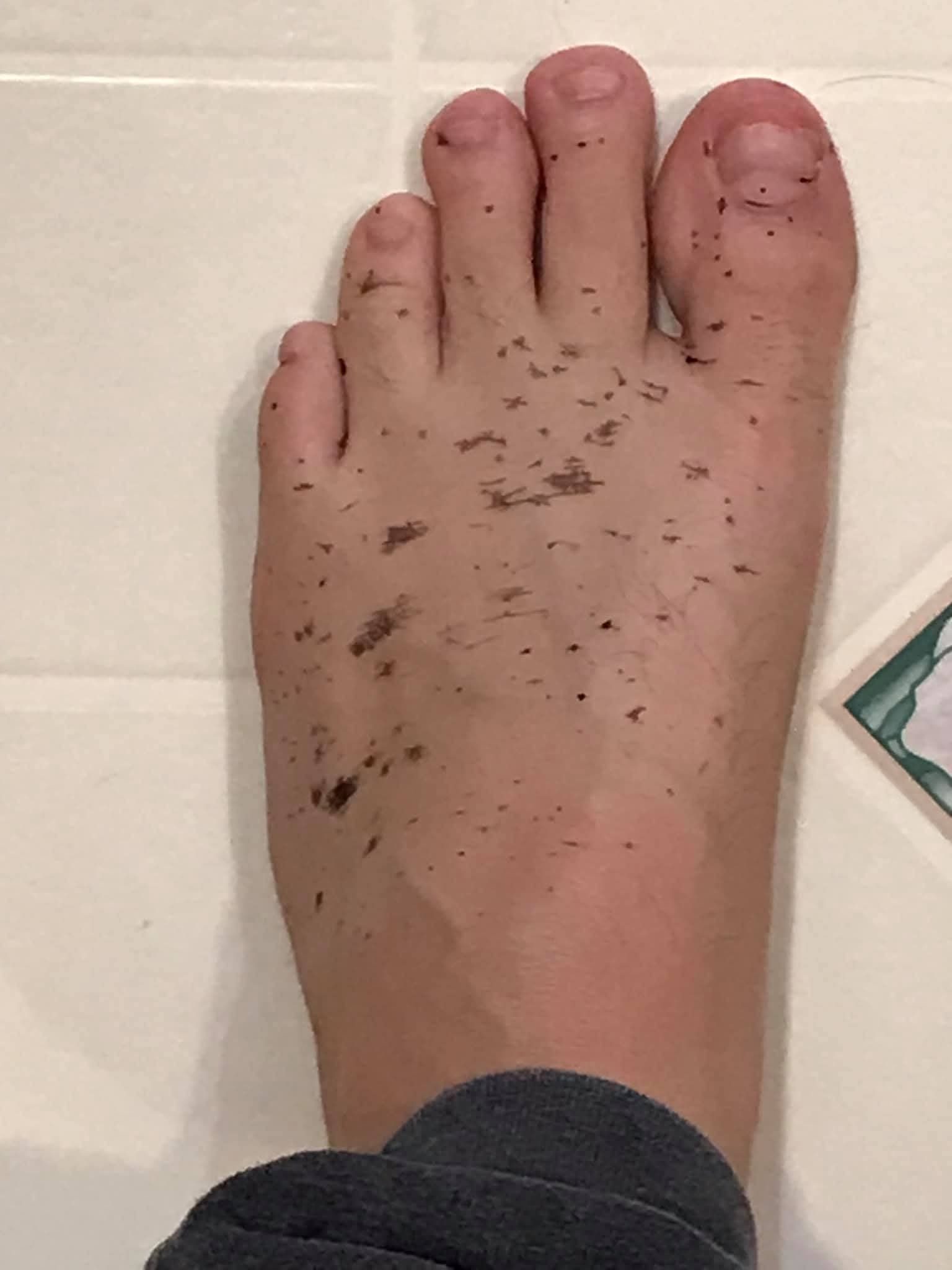 Matt Schultz's feet