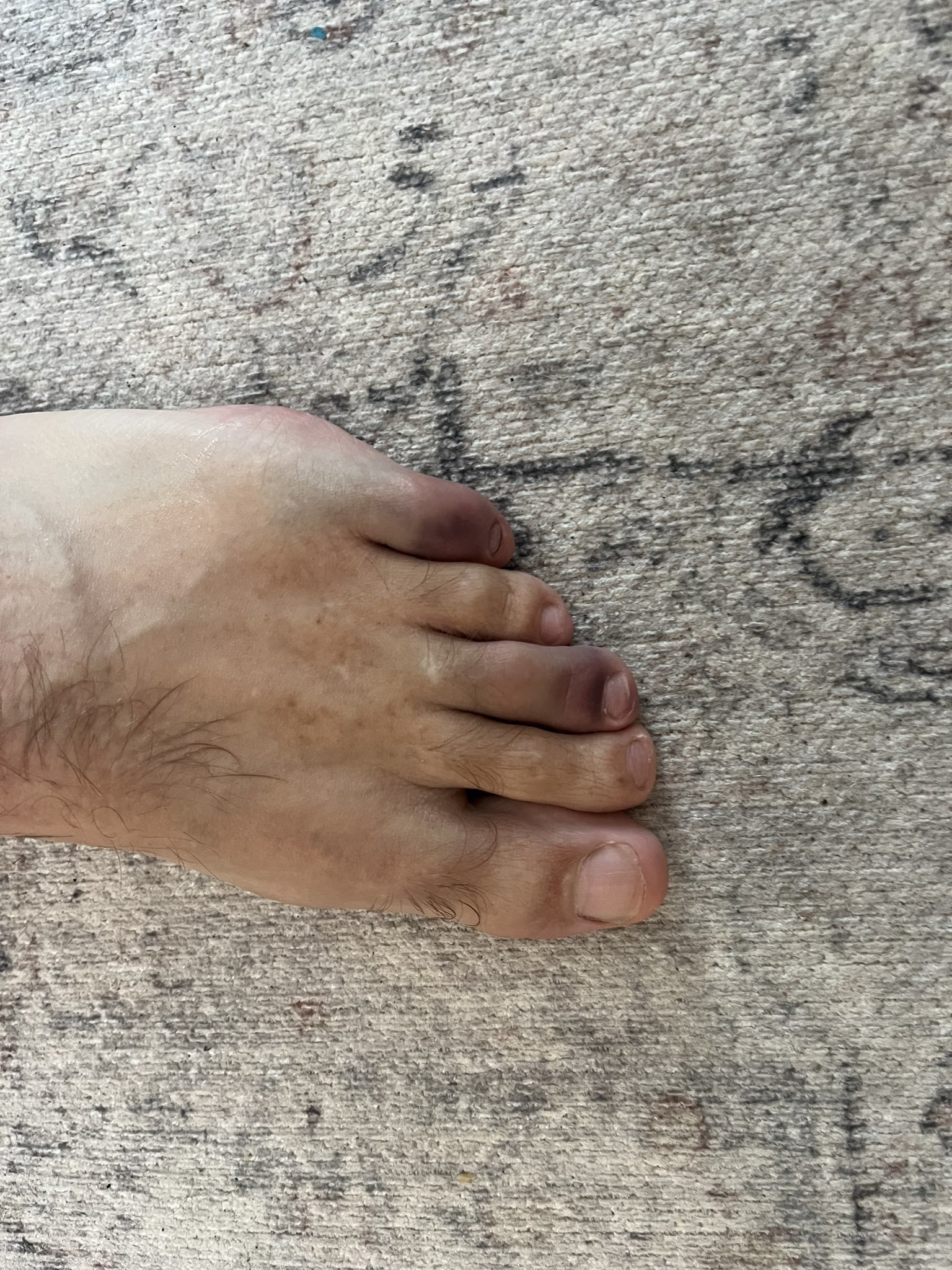 Matthew Marsden's feet