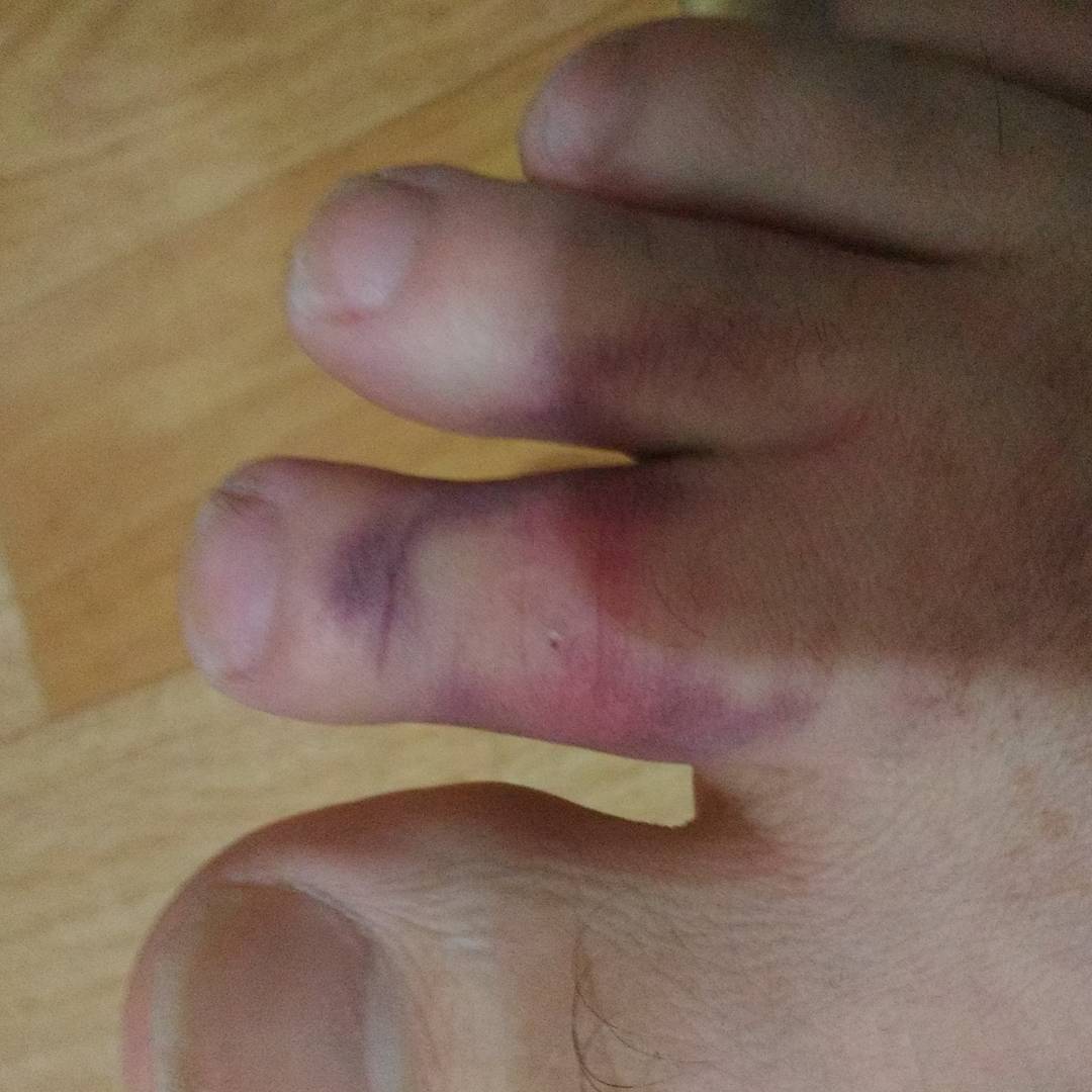 Rob Jabbaz's feet