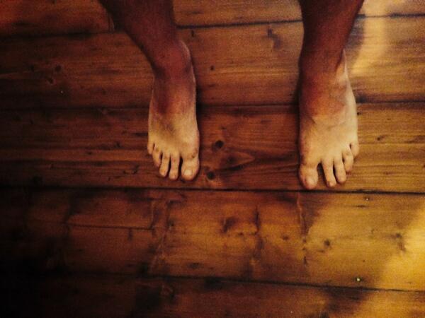 Rufus Jones's feet