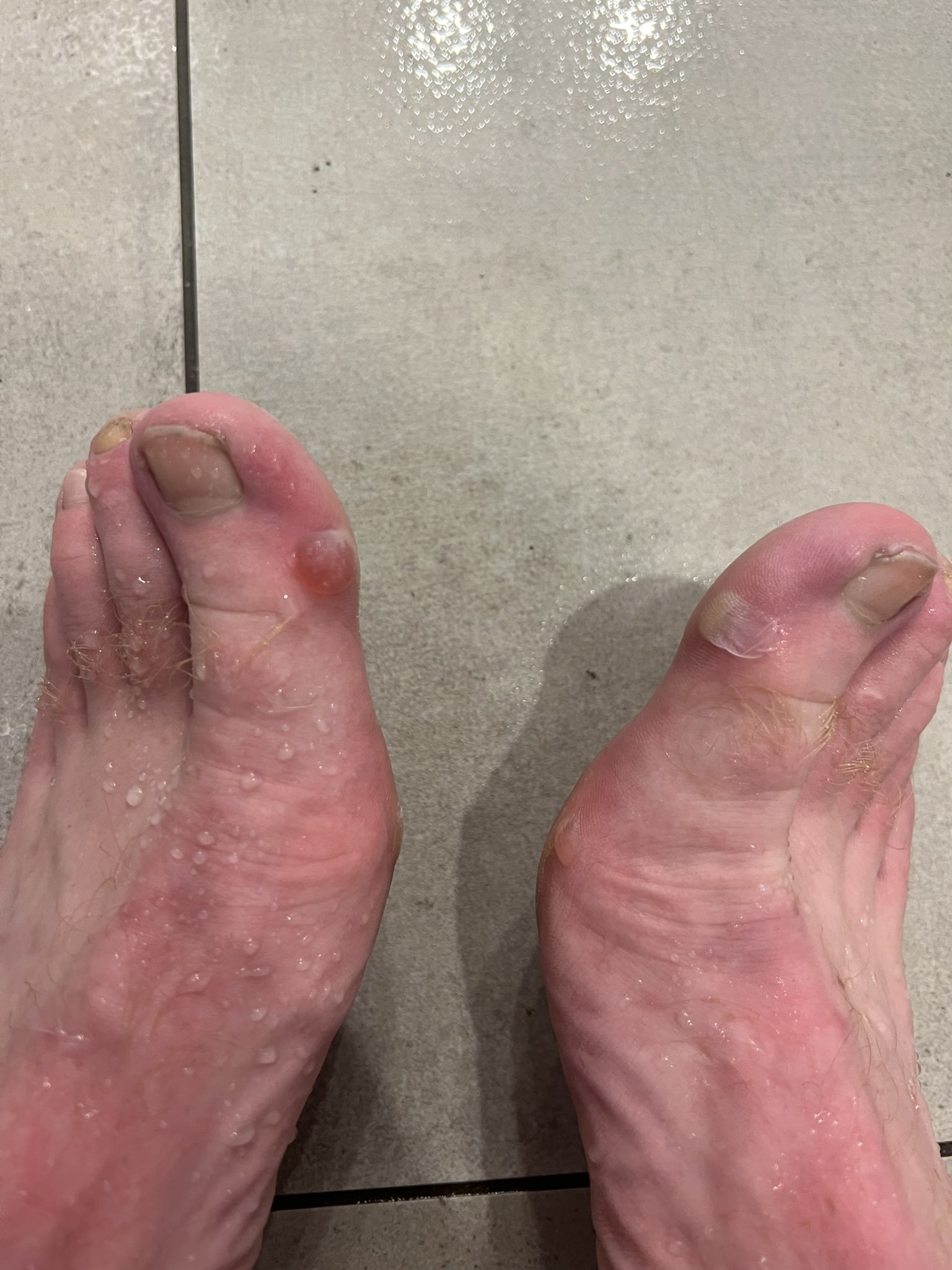 Russ Cook's feet